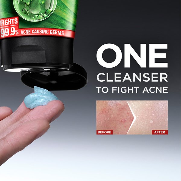 GARNIER MEN AcnoFight Anti-Acne Scrub in Foam Cleanser AcnoFight Anti ...