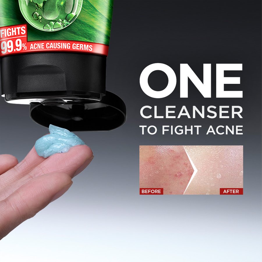 GARNIER MEN AcnoFight Anti-Acne Scrub in Foam Cleanser AcnoFight Anti ...